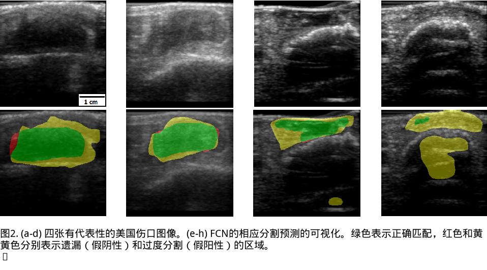 A pilot study of non-invasive monitoring of chronic wound healing using ...