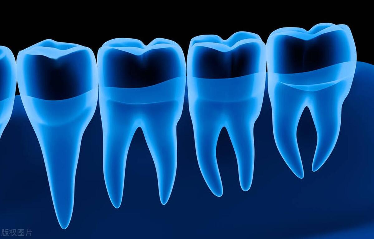 Why do people grow gums and teeth? - iMedia