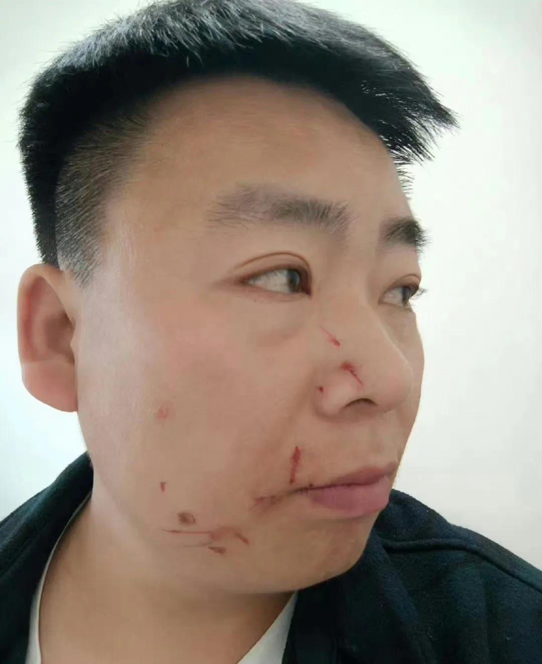 The special effects artist Yang Yang and Reba kissed passionately, but ...