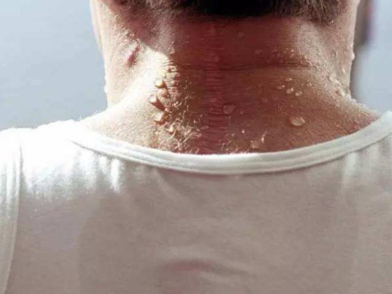 Where does sweat come from, where does disease come from, these 3 kinds ...