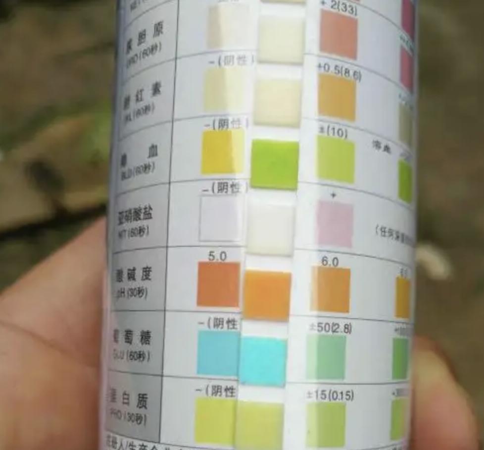 The shade of urine is a barometer of good health - iNEWS
