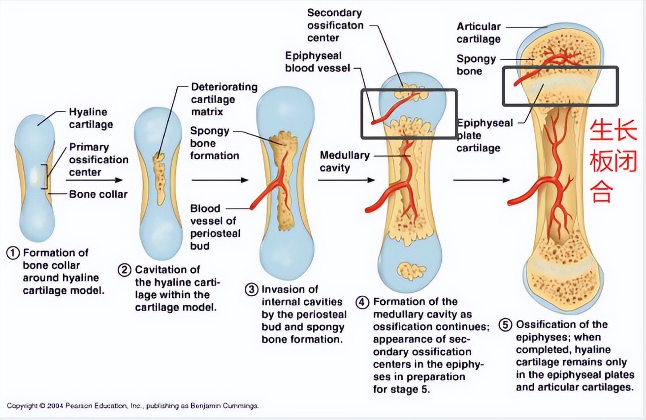Why is bone age so important? Bone Age Identification: How to Make ...