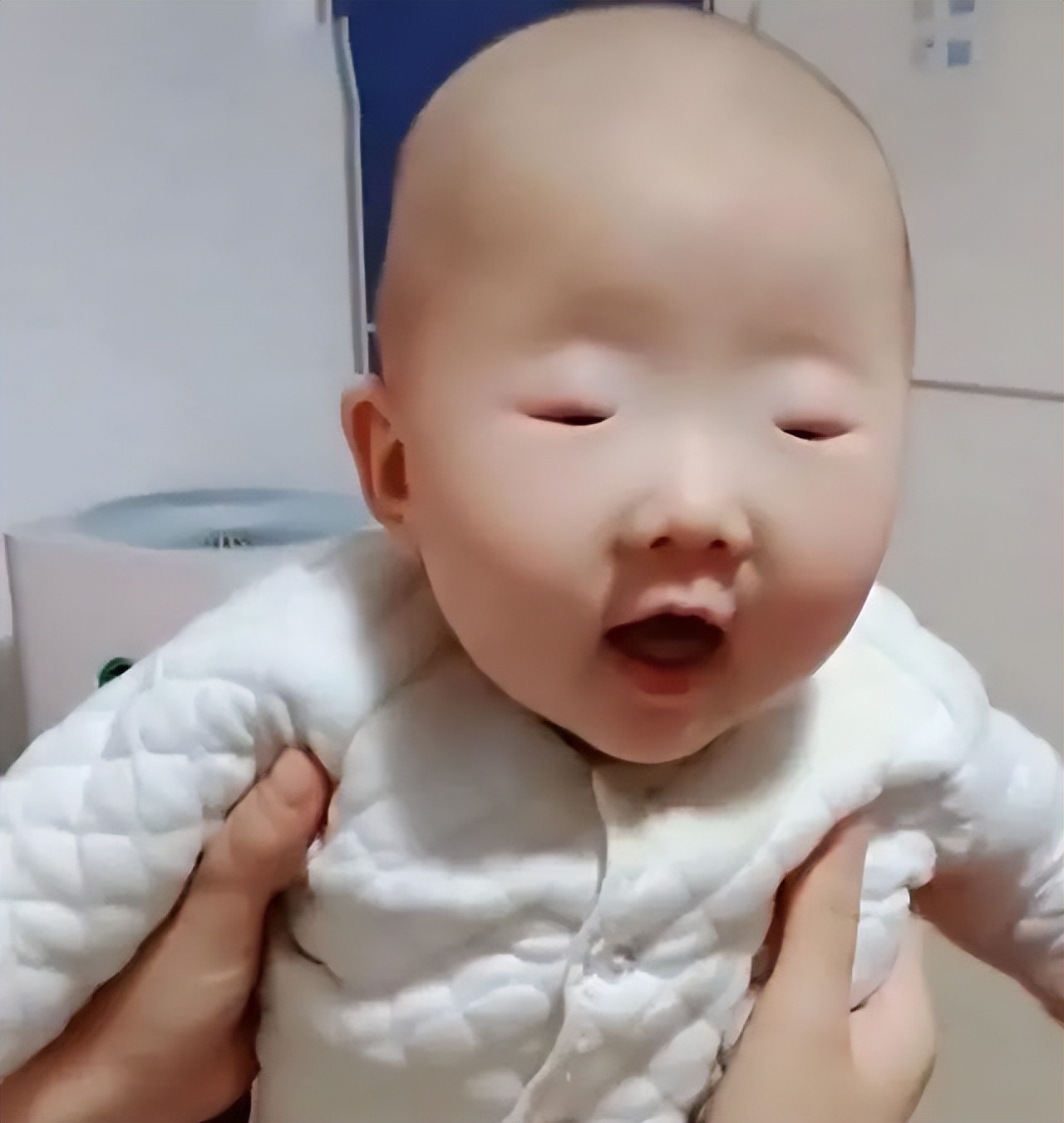 The "smallest eye" baby is on fire, and when he is awake, he is still ...