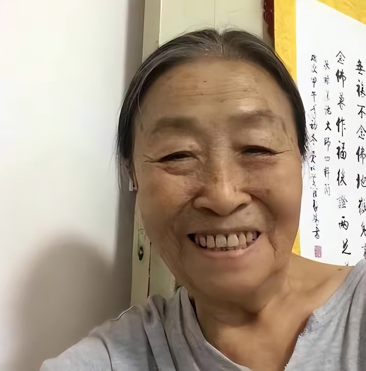 The most beautiful Fengxia suffers from a disability, Zhang Shaohua's ...