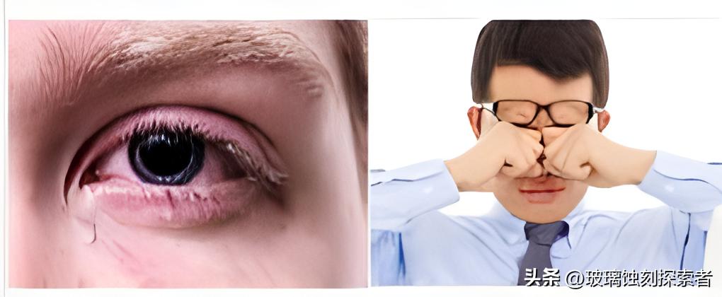 Anti-glare eye protection, 99% of people are full of praise for the AG ...