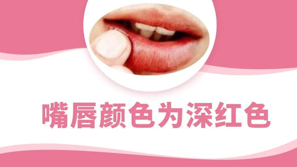How does TCM "read" the body from the color of the lips?Teach you all ...