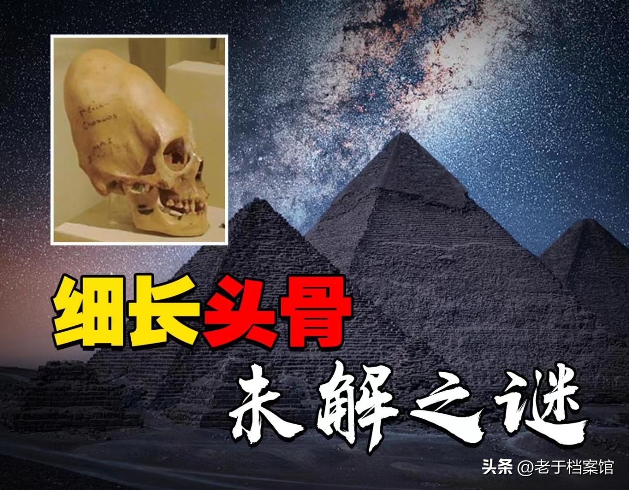 The origin of the Paracas skull is a mystery, genetic testing, is it an ...