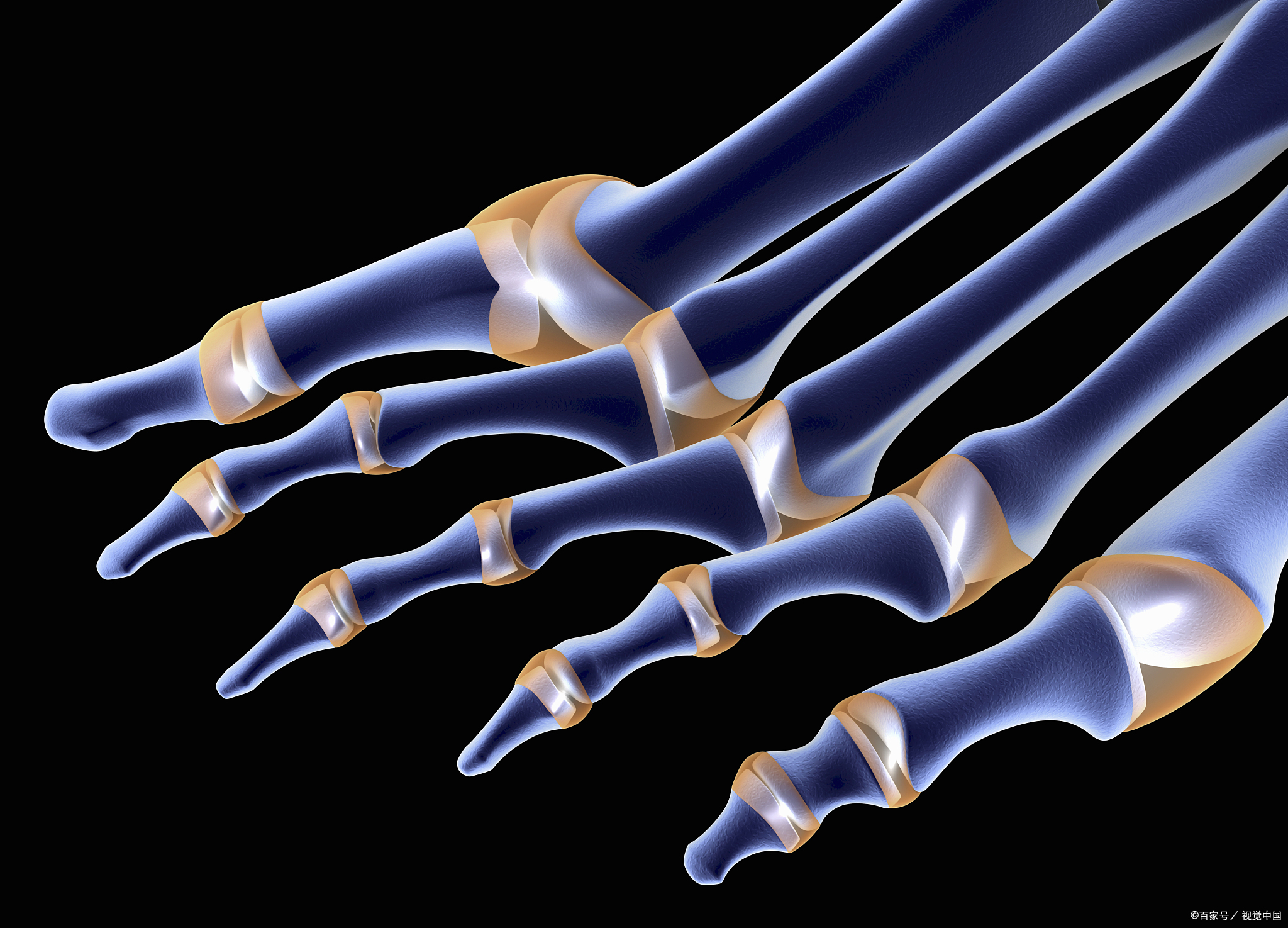 The bones and joints always make noise, what's the matter? - iNEWS