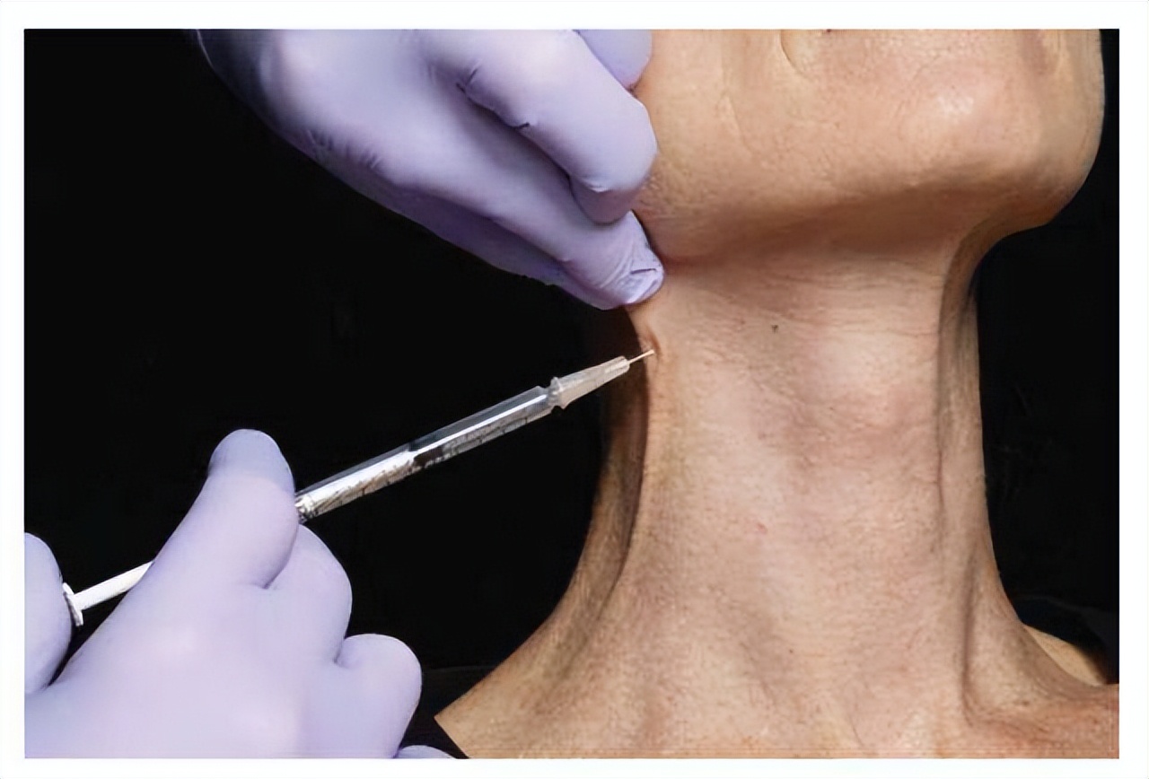 Deep neck lines can be solved in 3 ways to make you look younger - iNEWS