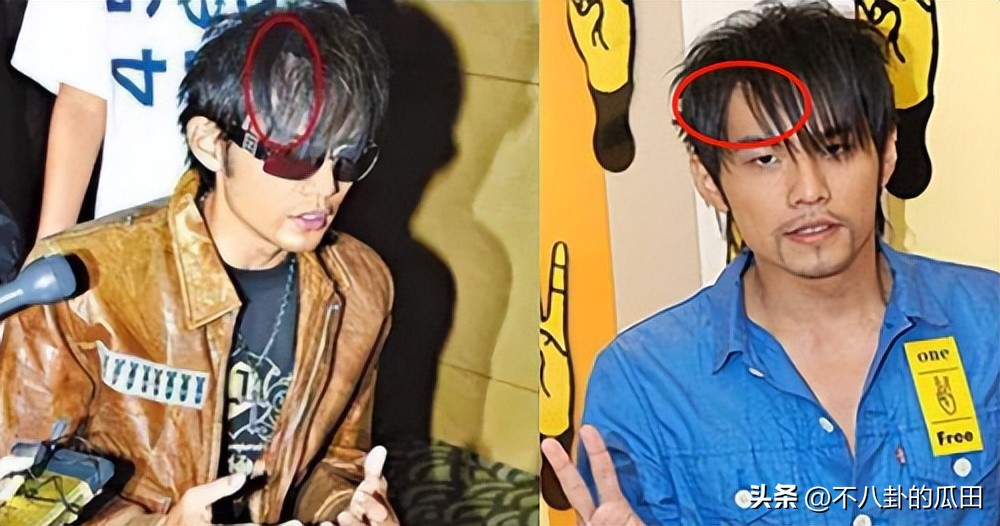 It turns out that the male stars have long been bald, Huang Xiaoming ...