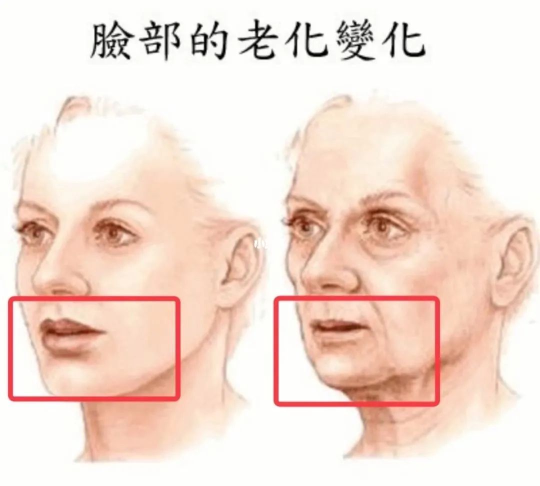 Perioral aging, which is both old and bitter, is reversible? - iNEWS