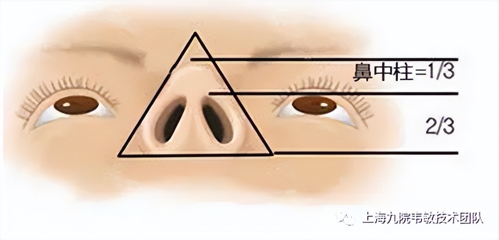 Do you understand the elongation of the nasal columella? - iNEWS