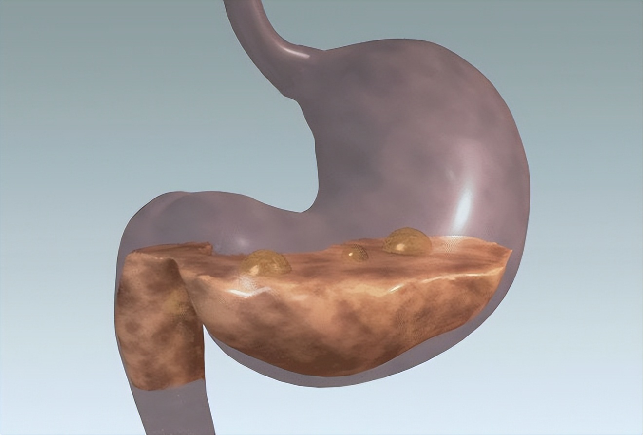 Have a bad stomach and can't eat? Stick to these 5 things and restore ...