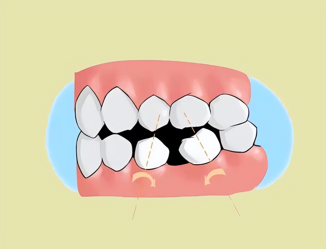 Long life, tooth prophet? How many teeth are normal for a 60-year-old ...