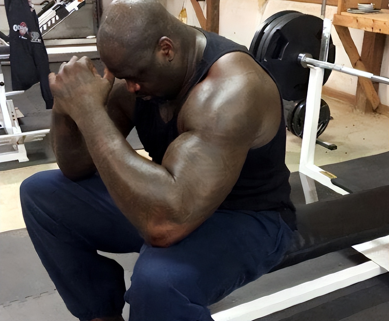 This is called "unicorn arm"! O'Neill's arm looks like an inflatable ...