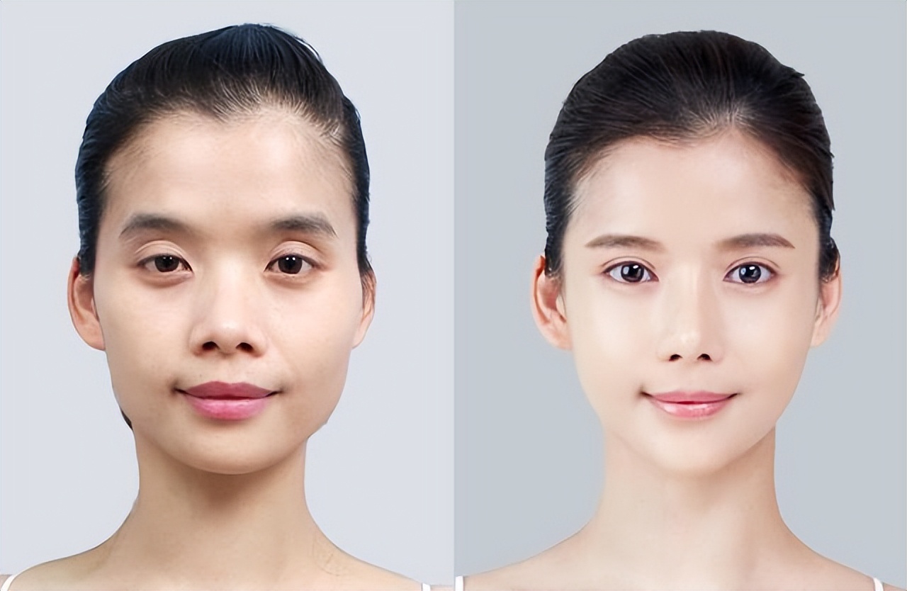 "Changed face" is also called pure natural, one is more unnatural than ...