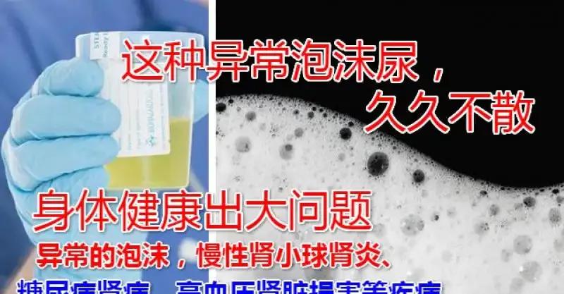 What is the difference between foamy urine and proteinuria?To get rid ...