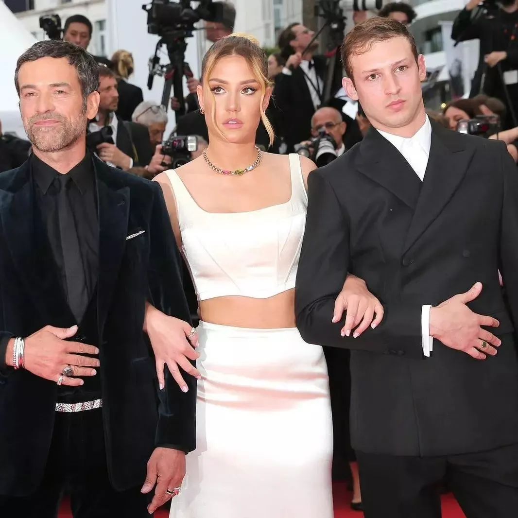 29-Year-Old Israeli Actor Goes Bald in His Twenties With Hair ...