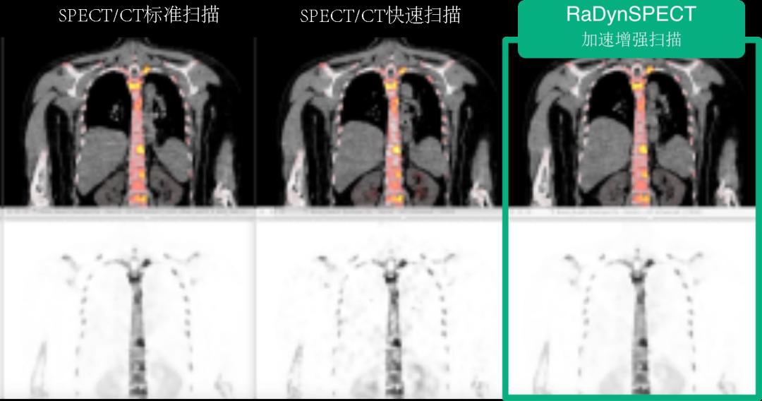 One article to understand the importance of SPECT in nuclear imaging ...