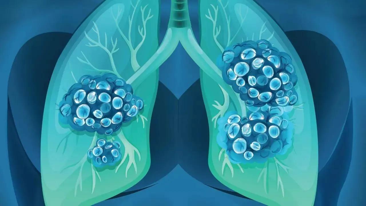 How does smoking affect the immune system? - iMedia
