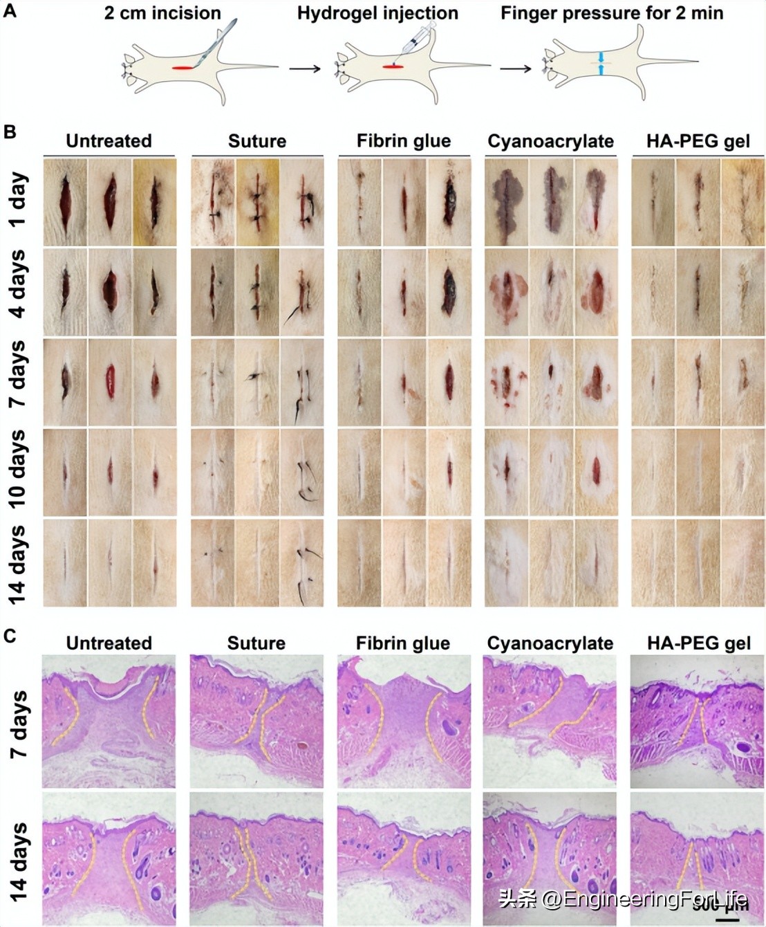 "Sci. Adv.": Injectable, self-healing hydrogel adhesive for seamless ...