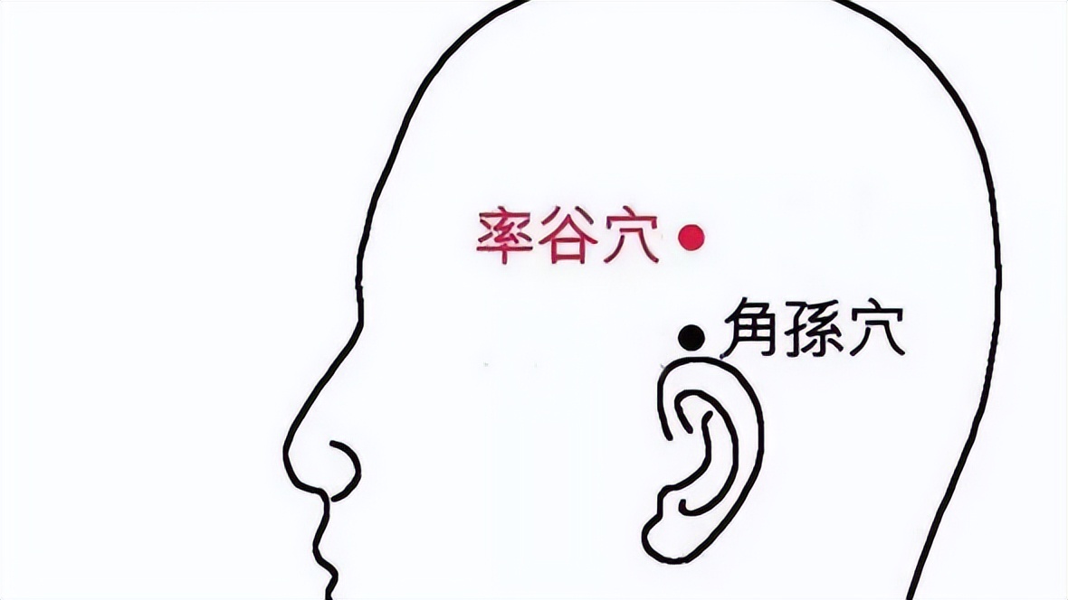 Learn these three acupuncture points to keep you away from migraines ...