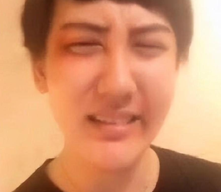 Long time no see Internet celebrity "Snake Man" Liu Zichen, changed his previous pointed chin ...