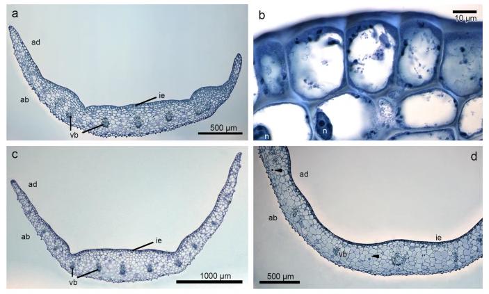 Clues to potential antimicrobial activity in black orchids, and vectors ...
