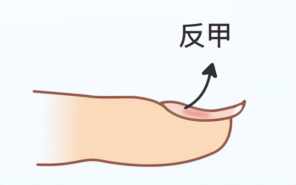 6 kinds of nail conditions are made public, understand physical ...