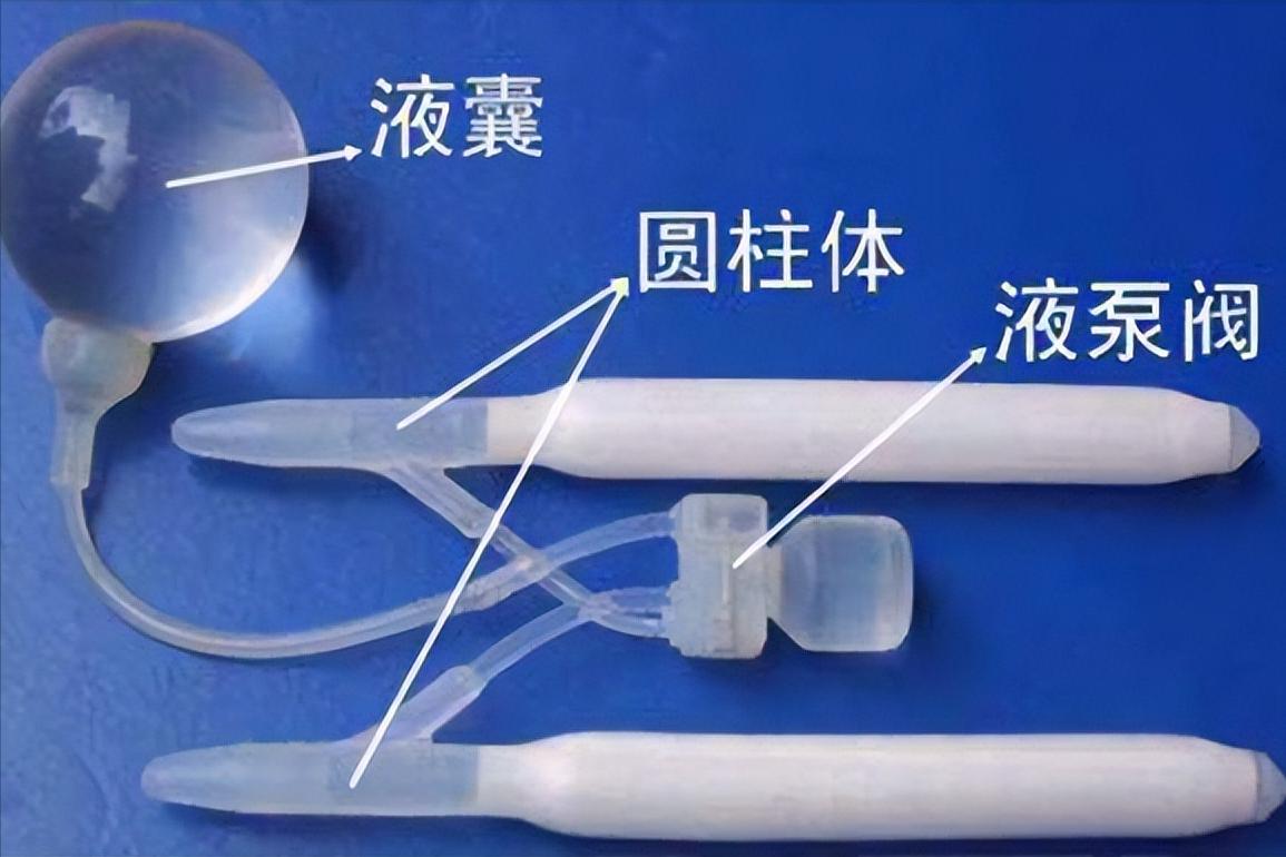 "Artificial Ding Ding" with motor, "male problem" is no longer a ...