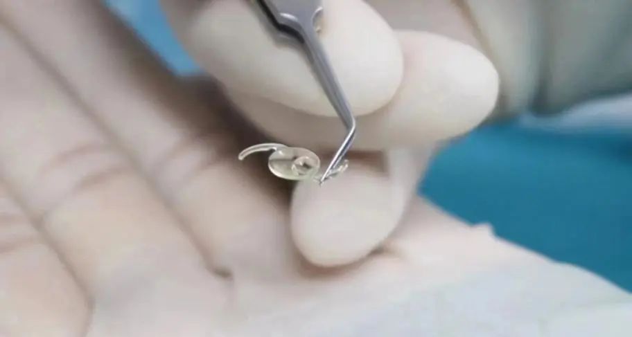 TECNIS Synergy™ Intraocular Lens Implantation Surgery Completed in Preh ...