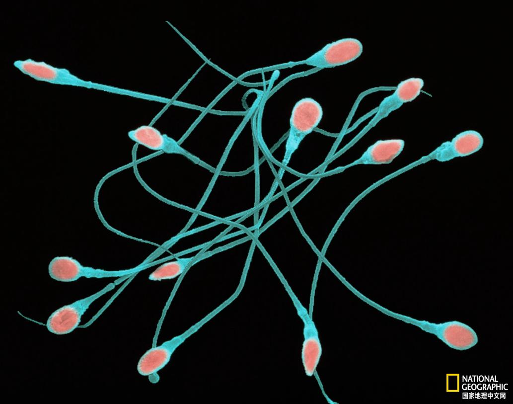 Global sperm counts are falling faster than thought - iNEWS