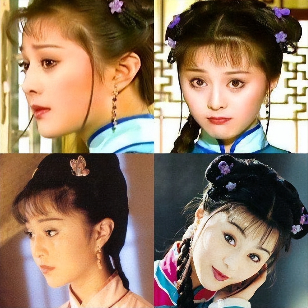 Is it plastic surgery or disease? Entertainment star plastic surgery ...