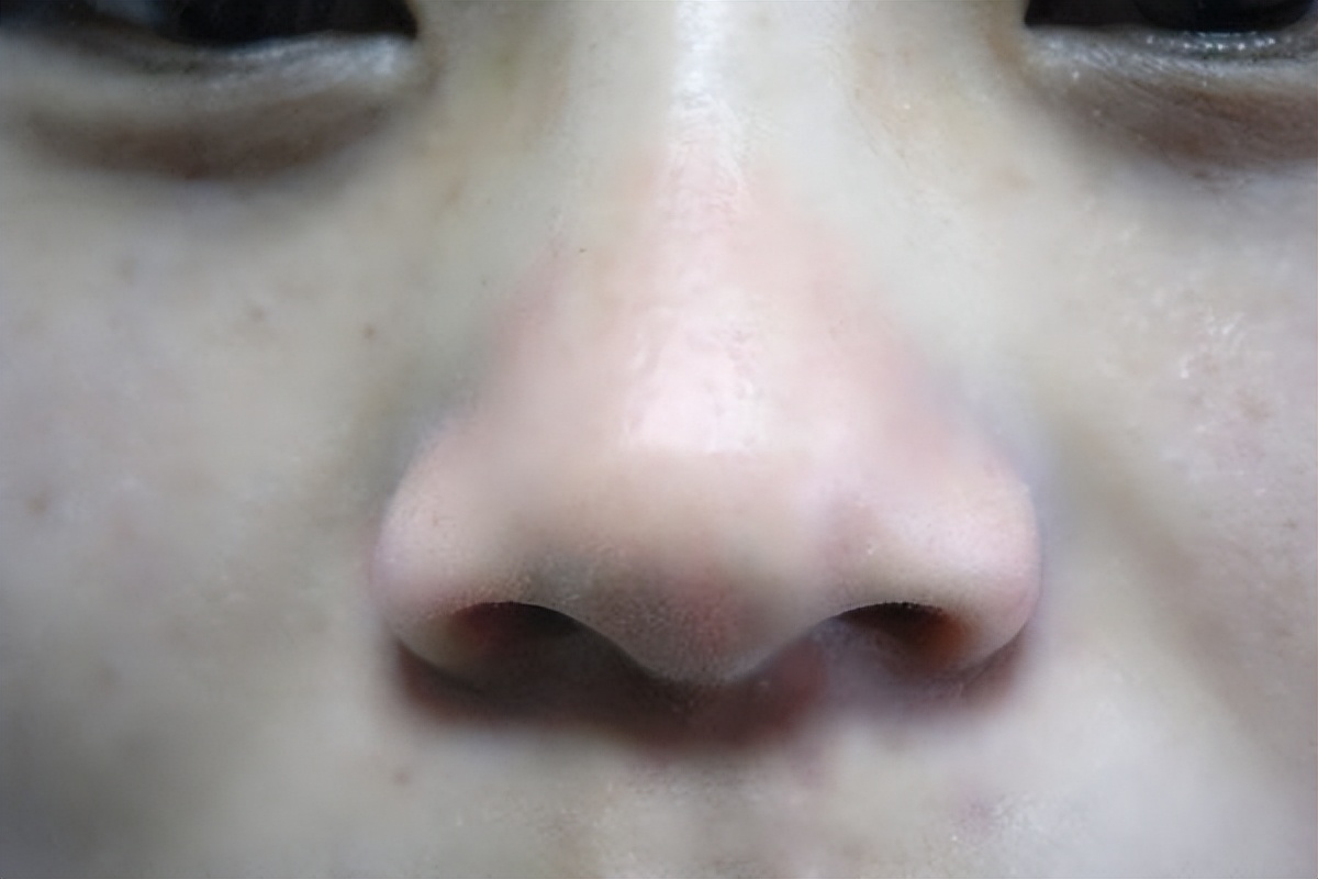 The nose hair grows to "snap out", should it be pulled out? The doctor ...