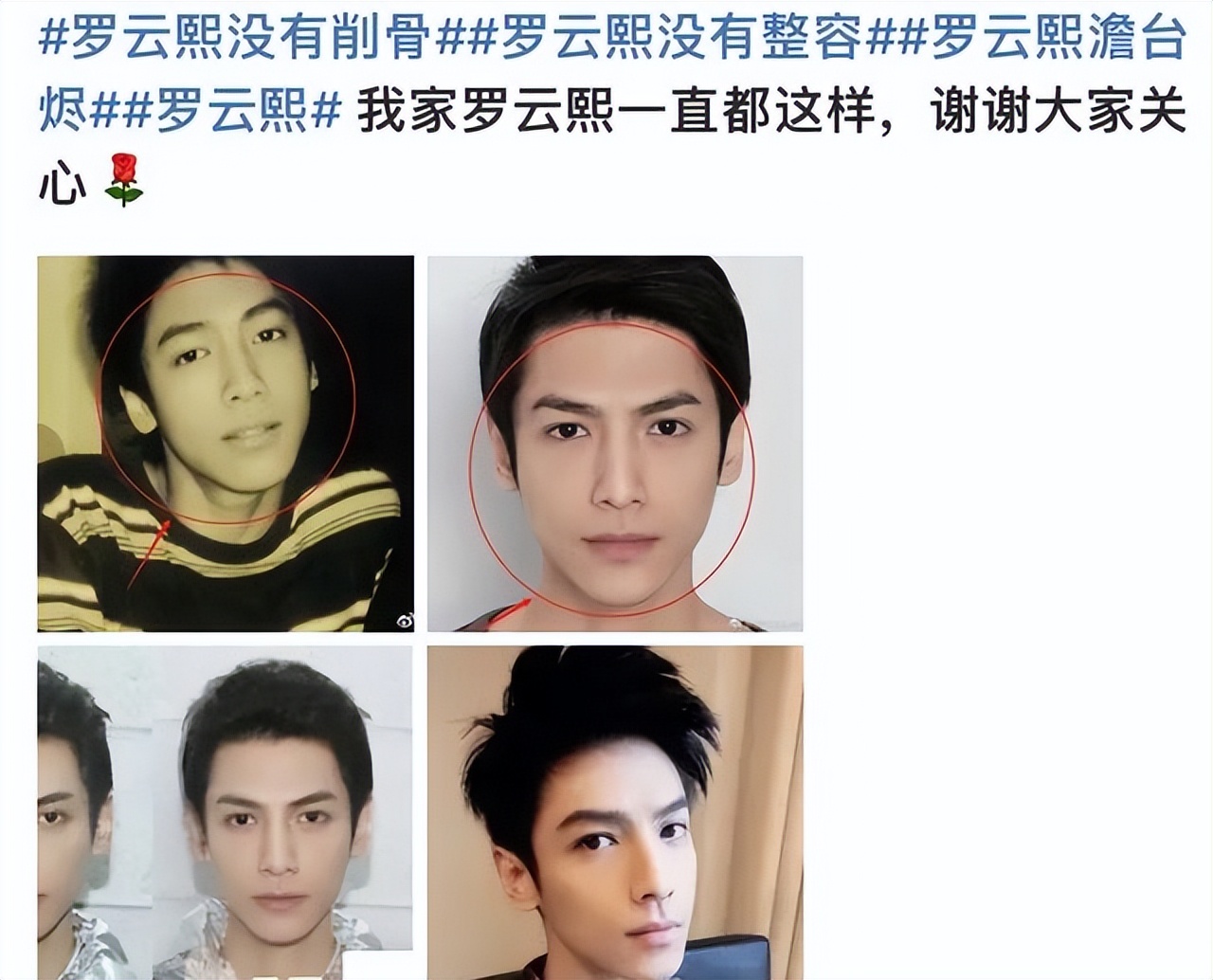 "Till The End Of The Moon" Luo Yunxi plastic surgery or skinny? This is ...