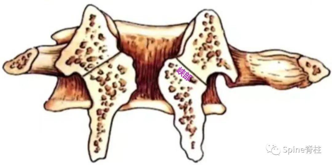 Anatomy of the isthmus and diagnosis and treatment of lumbar ...
