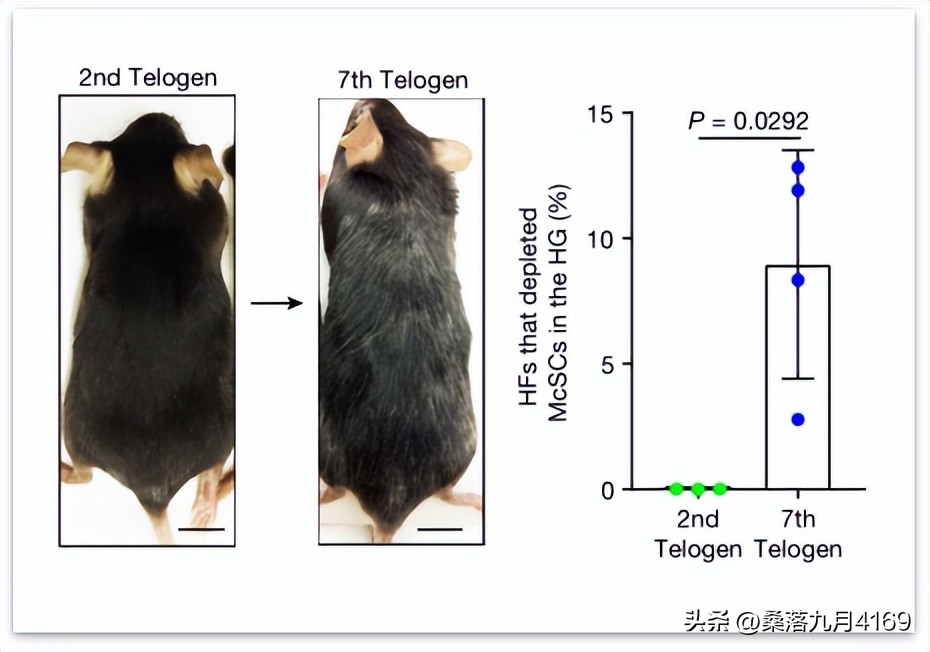 Nature: There is hope for white hair to turn black! New study finds ...