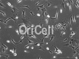 An ideal cell model for fat metabolism - 3T3-L1 cell line - iNEWS