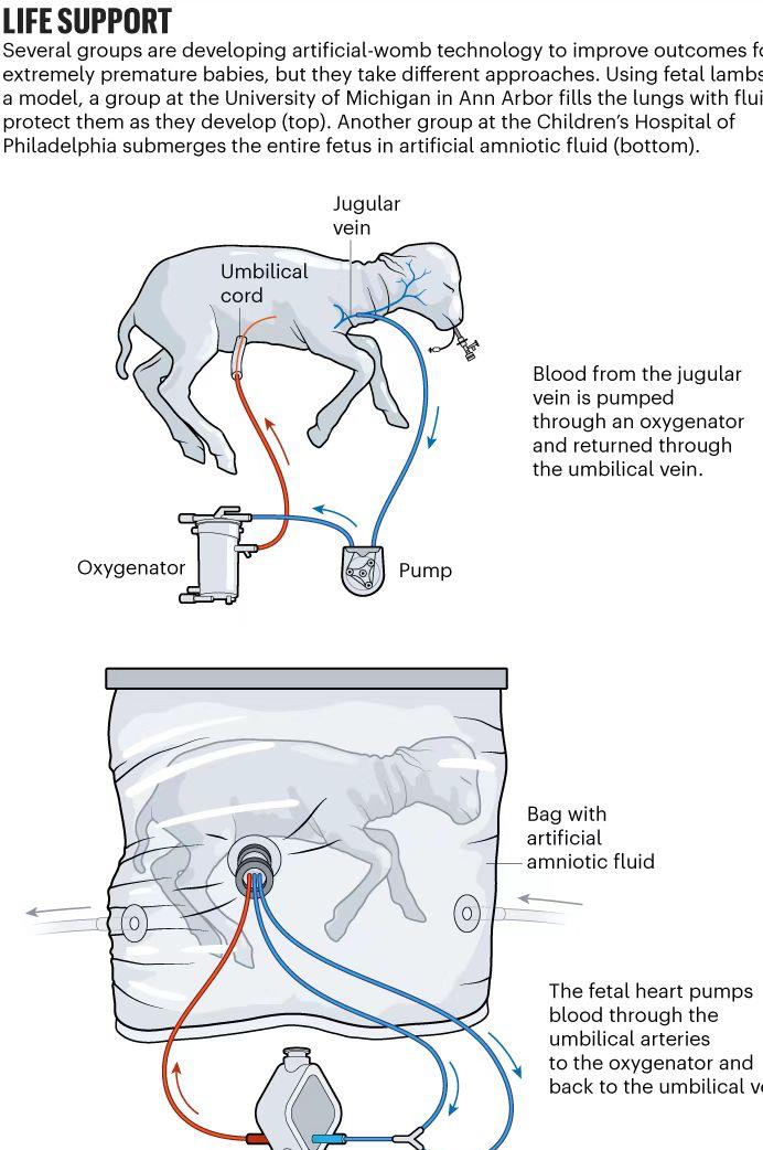Breakthrough progress! The world's first artificial womb experiment is ...