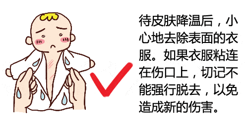 After a child is scalded, remember the 5-character formula for ...