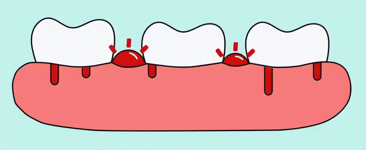 When your teeth send you these cries for help, you need to be noticed ...