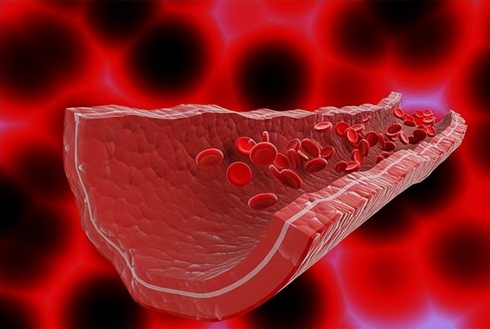 These "five toxins" have the greatest damage to blood vessels, and any ...