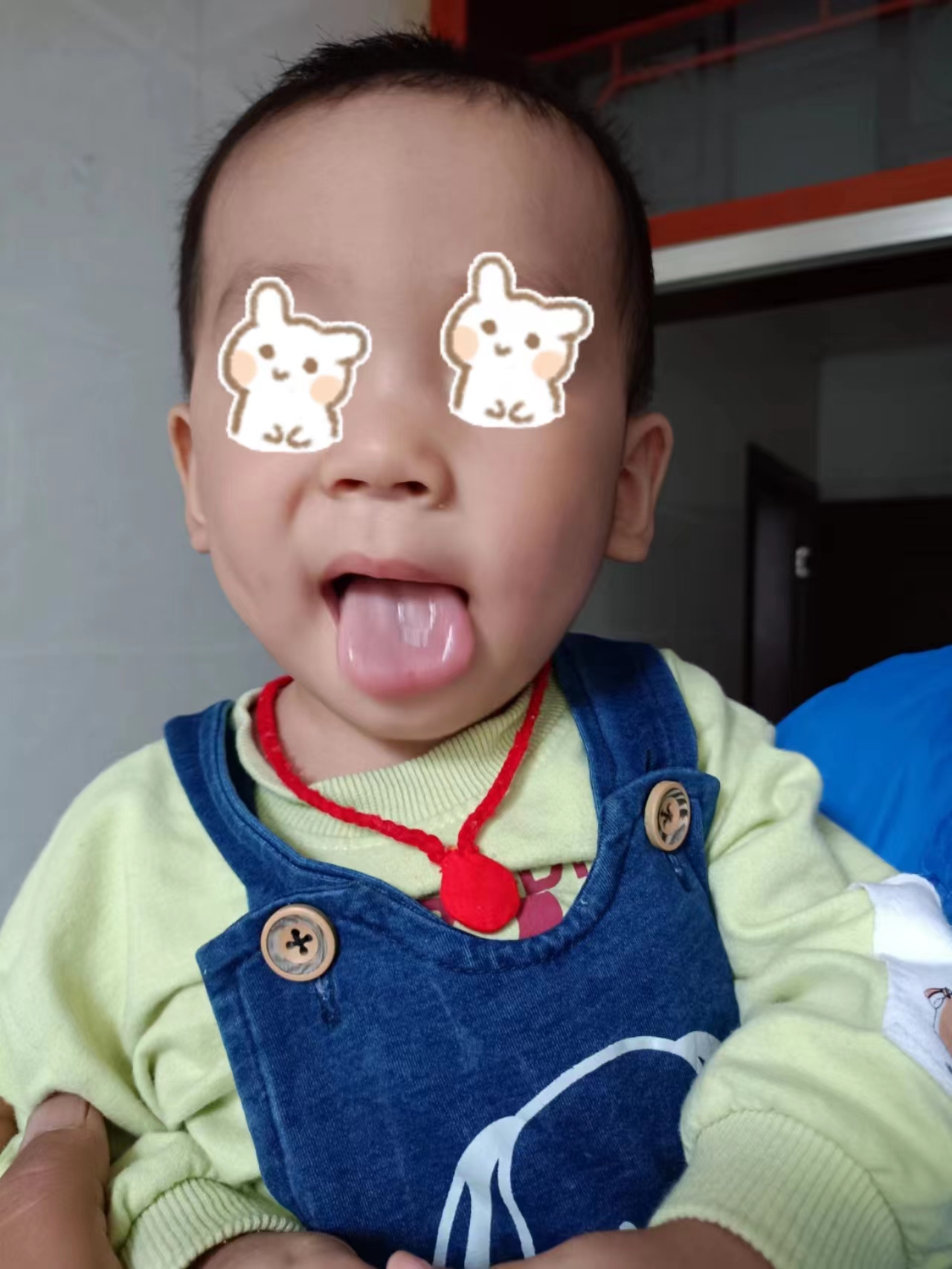 The recovery of chancre baby - iNEWS