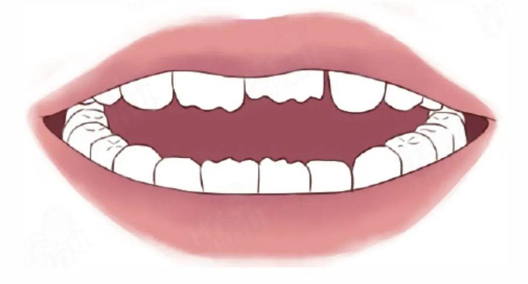 Kunming Changpeng Dental: Why are the new teeth of the child replaced ...