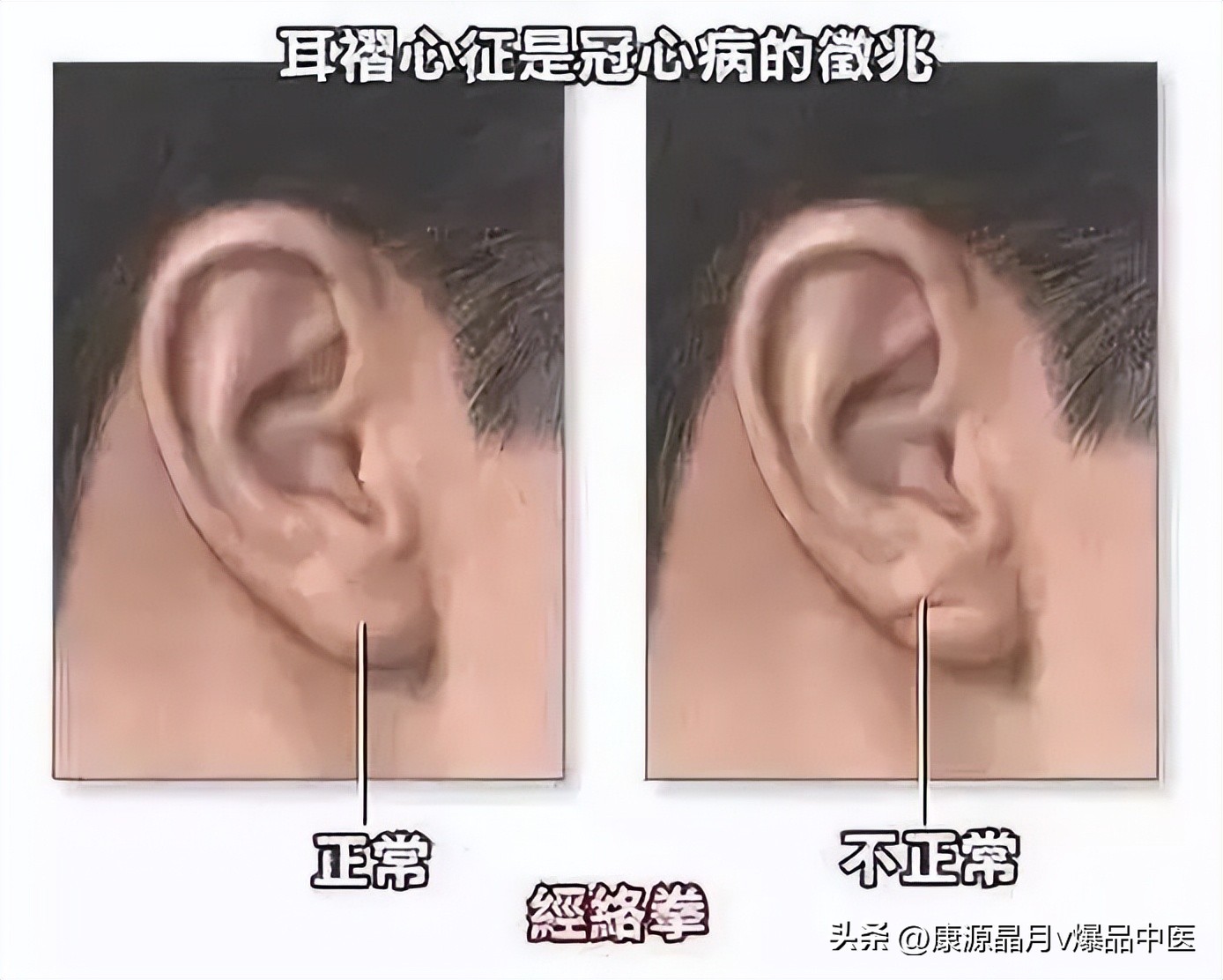 Ear diagnosis stunt, massage and rubbing to cure all diseases - iNEWS