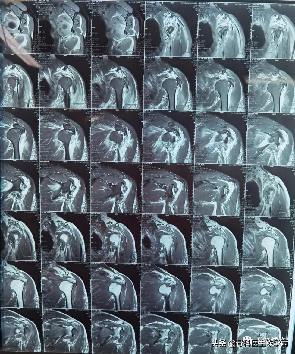 Difficulties still need to be carried on your shoulders, old ...