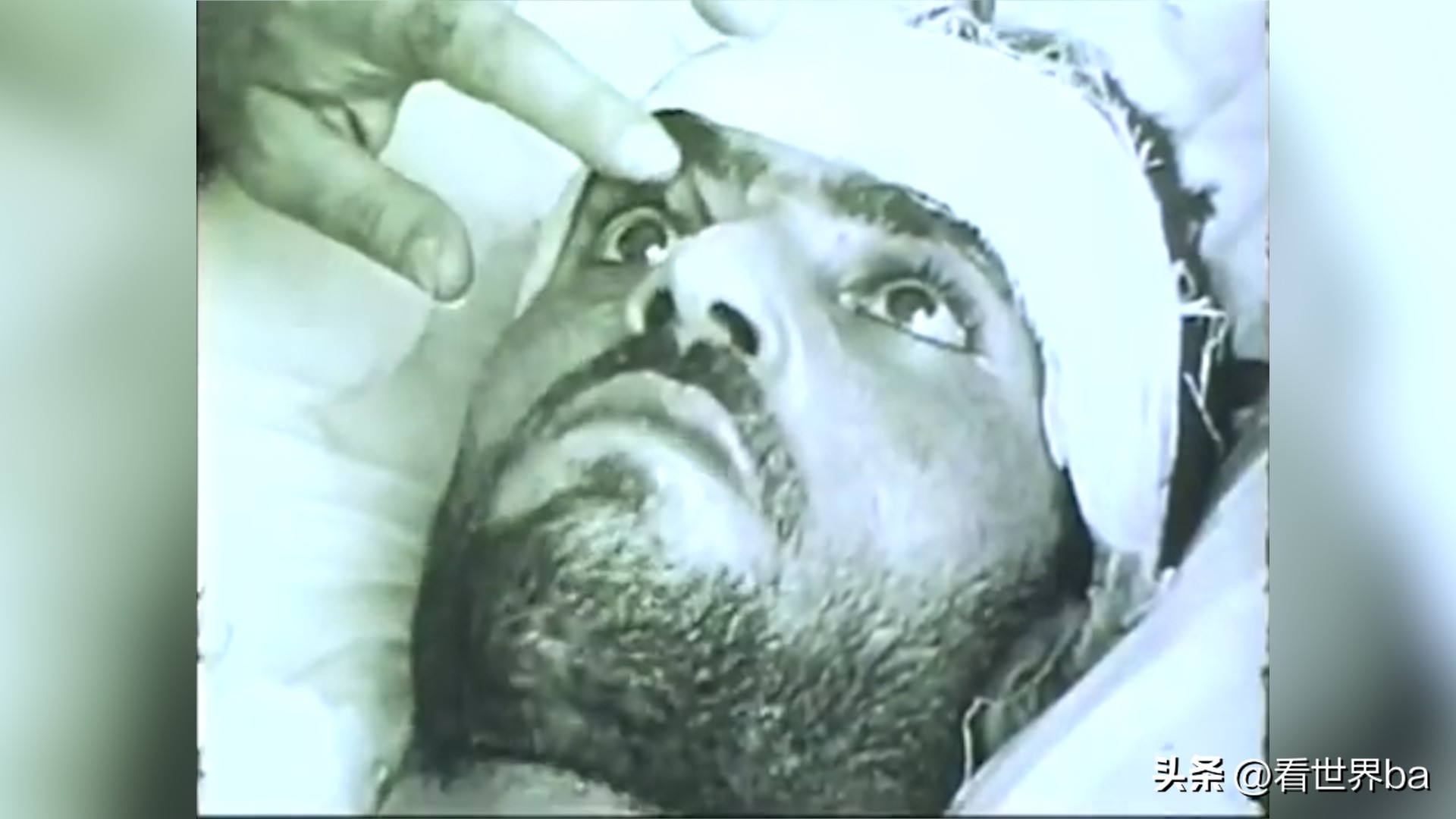 How scary is rabies? The doctor photographed the real scene of the ...