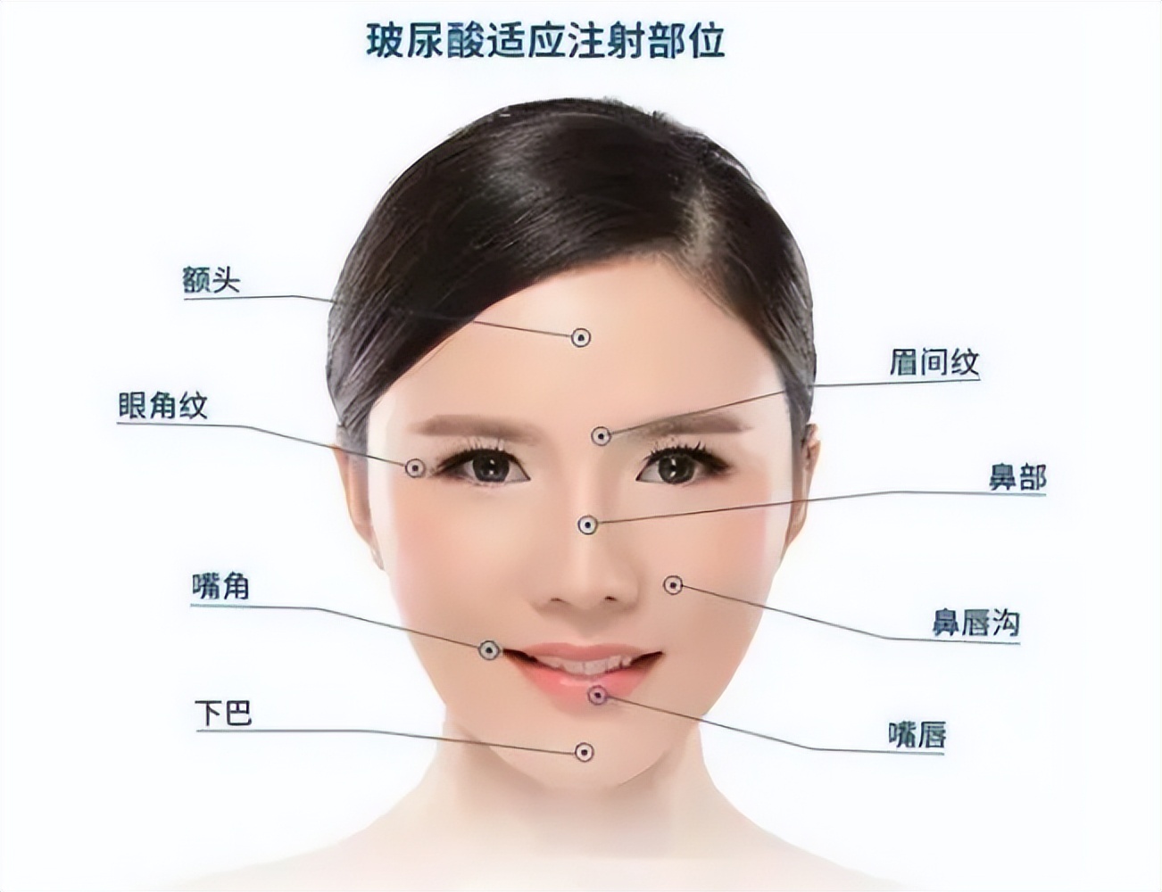 Is it better to use body fat or hyaluronic acid for facial fillers? - iNEWS