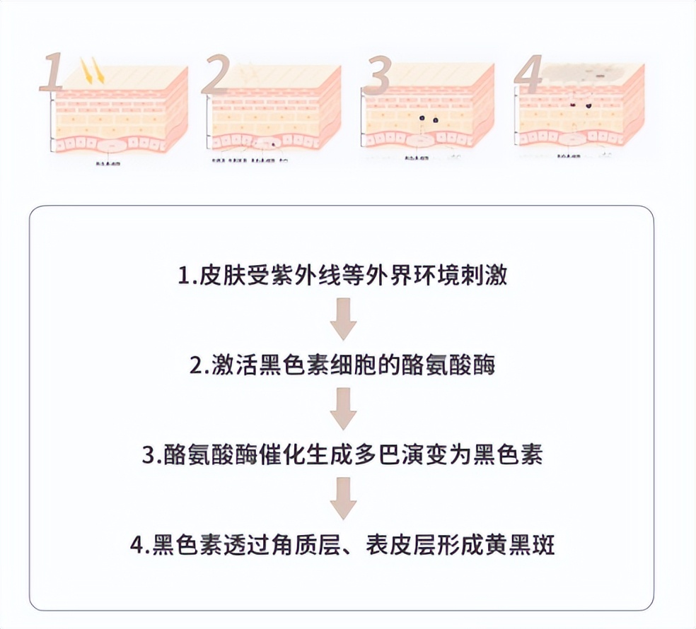 After understanding these seven knowledge points about whitening, you ...