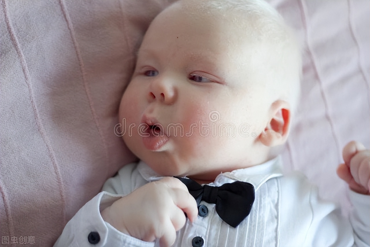 What are the causes of albinism? - iNEWS